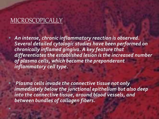 Clinical features and stages of gingivitis | PPTX