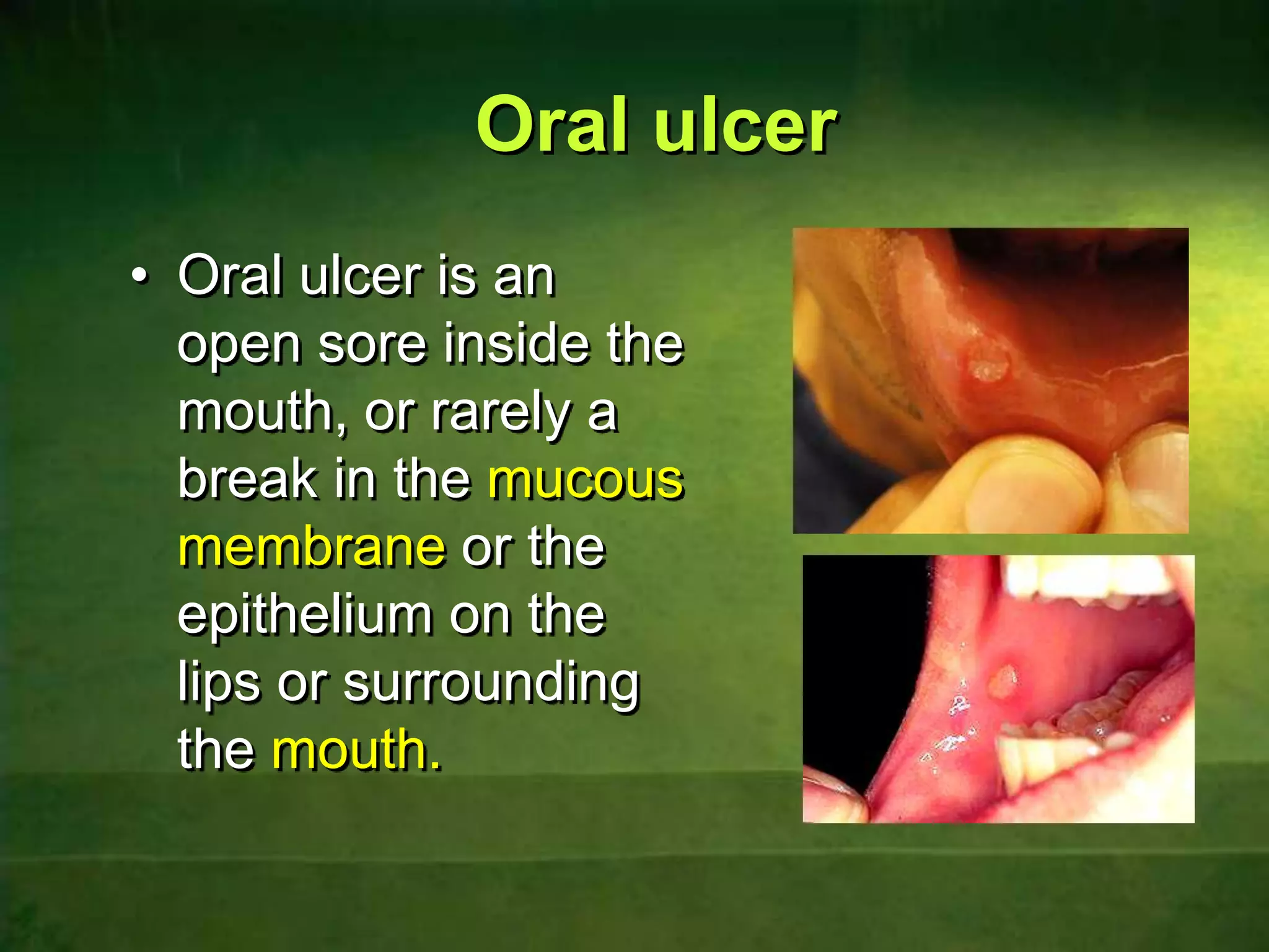 Clinical features of allergic stomatitis | PPTX