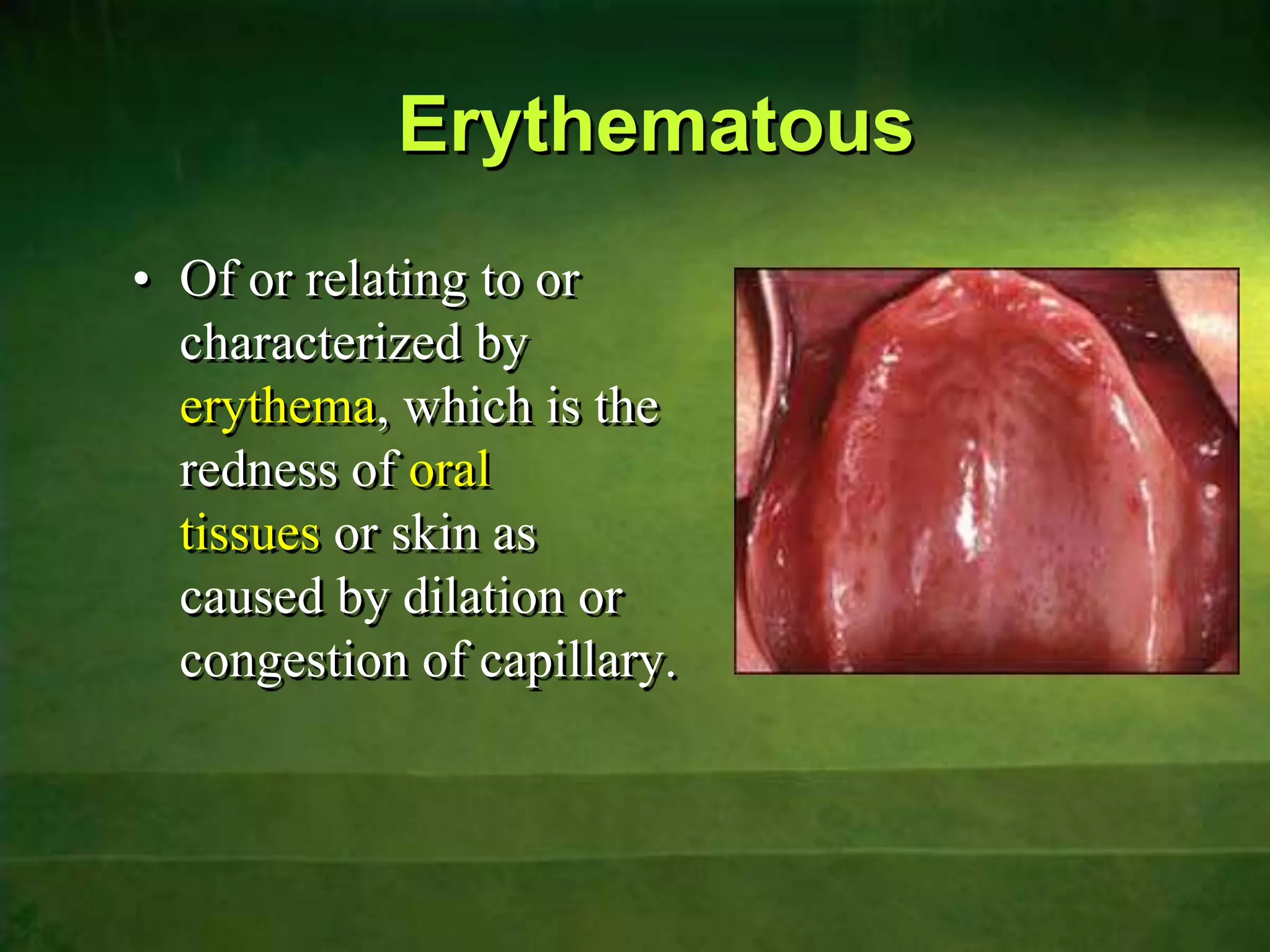 Clinical features of allergic stomatitis | PPTX