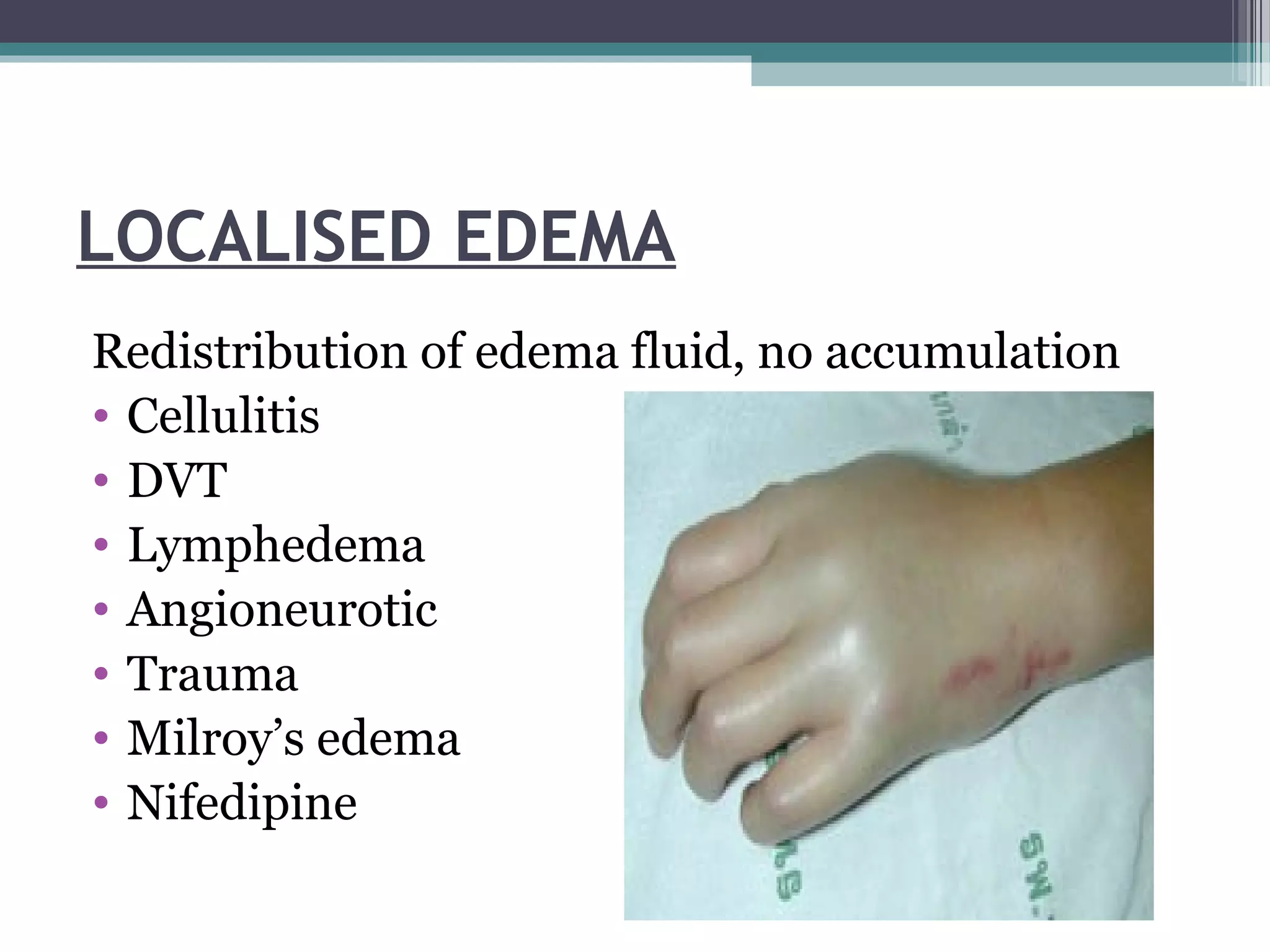 Clinical features of edema | PPT | Heart and Cardiovascular Diseases ...