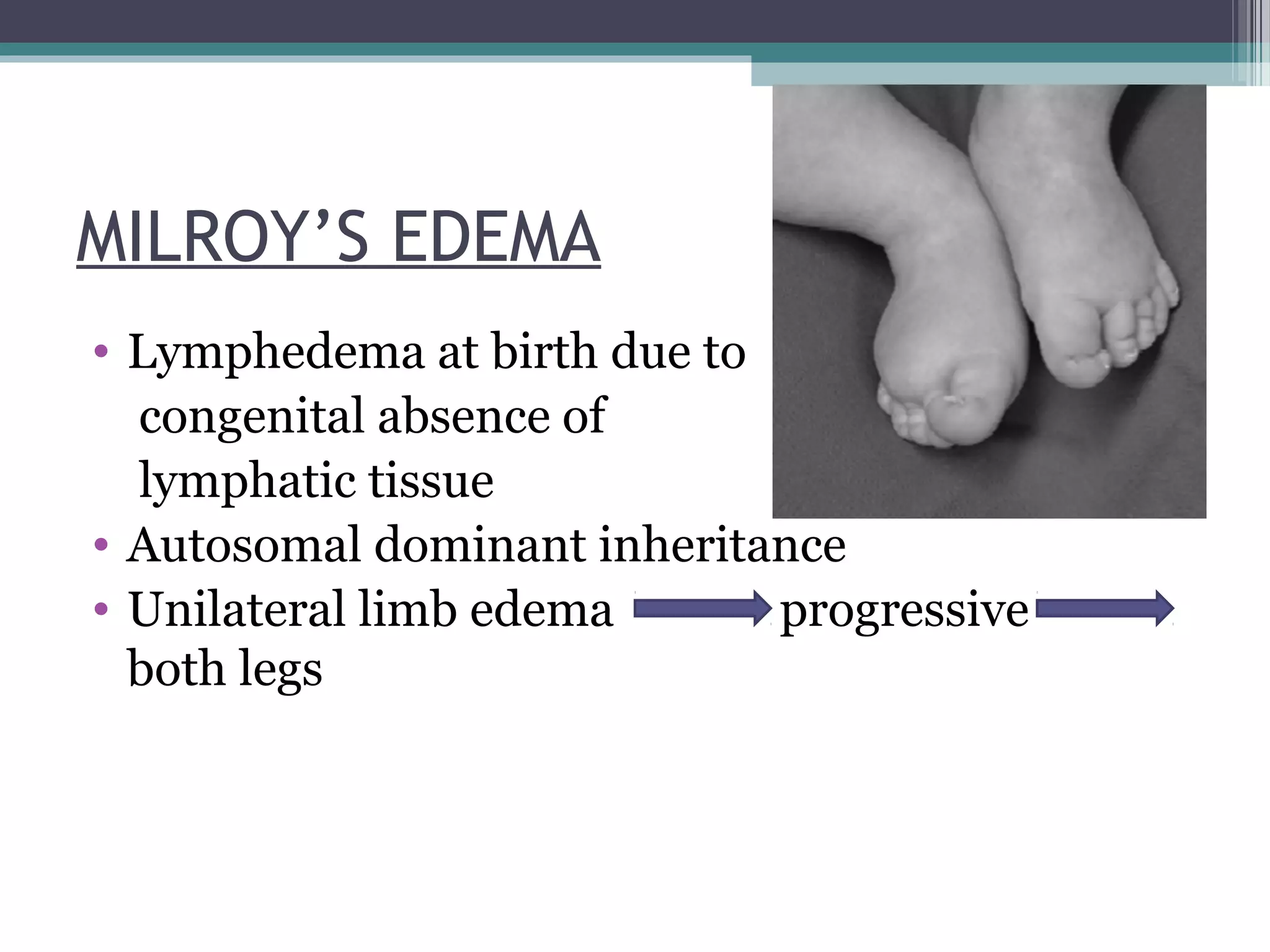 Clinical features of edema | PPT