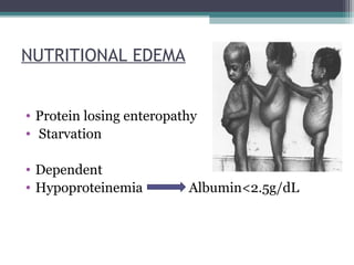 Clinical features of edema | PPT | Heart and Cardiovascular Diseases ...