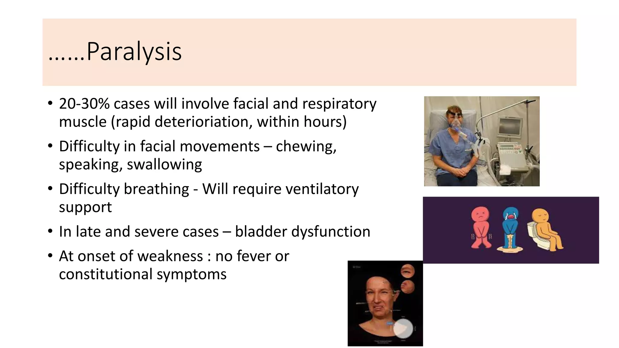 Clinical Features of GBS.pptx | Brain and Nervous System Disorders ...