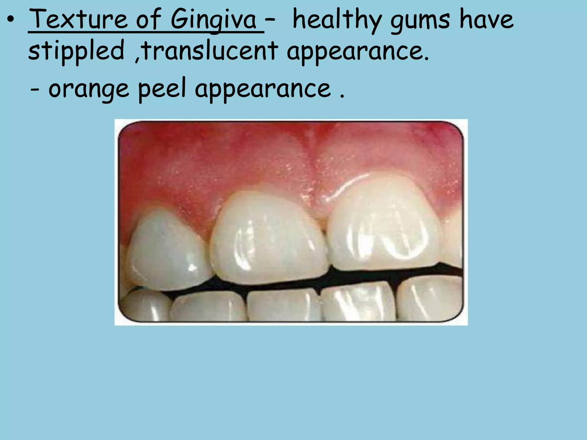 Clinical features of gingiva | PPTX
