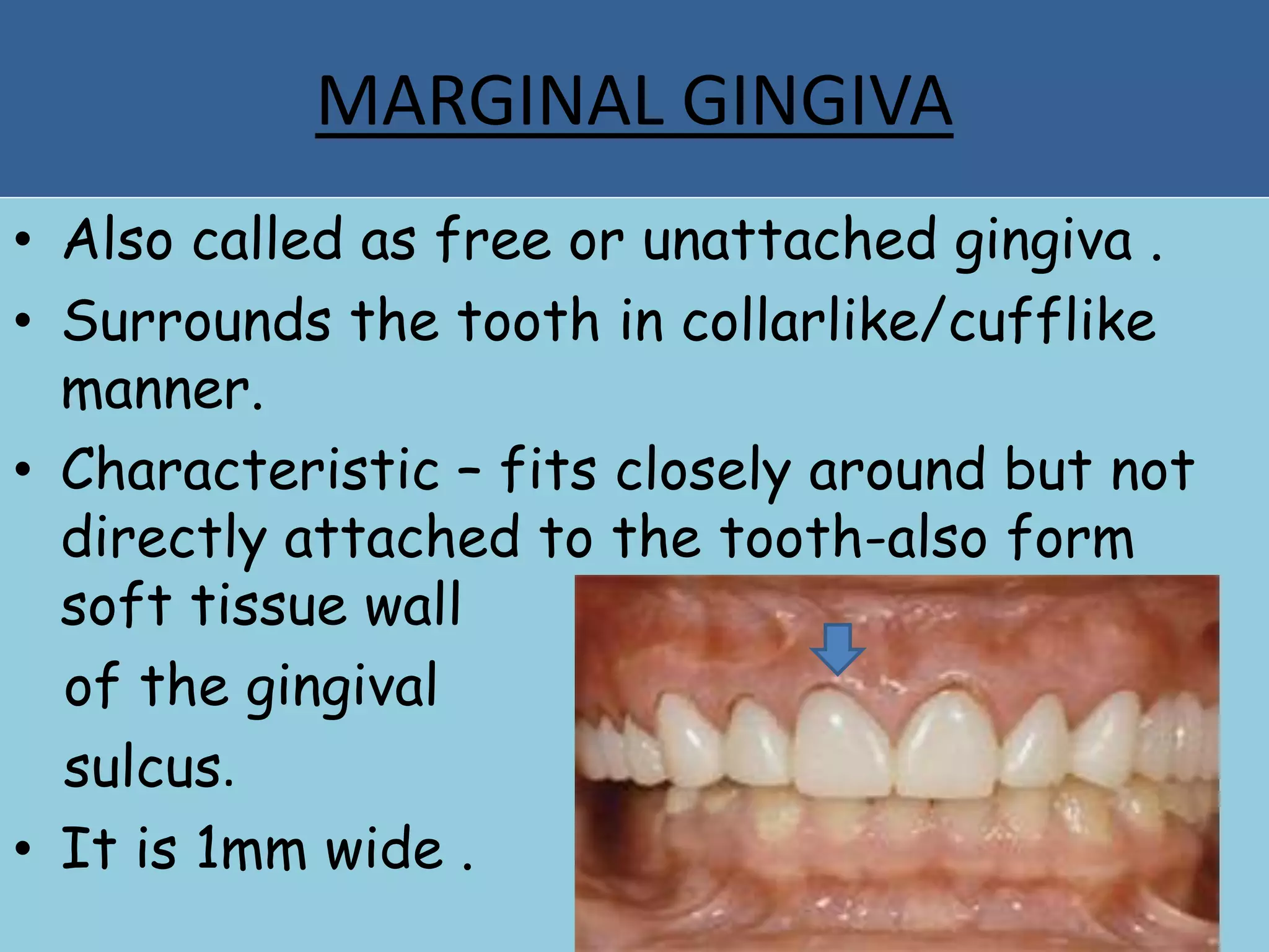 Clinical features of gingiva | PPTX