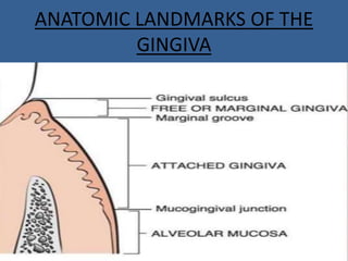 Clinical features of gingiva | PPTX