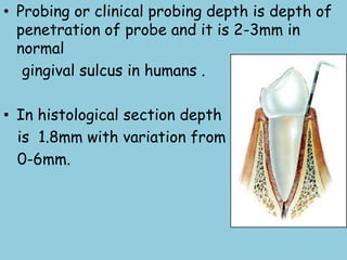 Clinical features of gingiva | PPTX