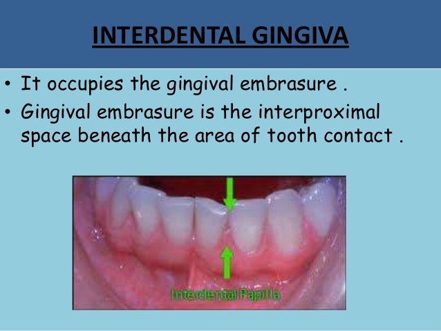 Clinical features of gingiva