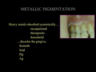 Clinical features ofgingivitis. periodontics | PPT
