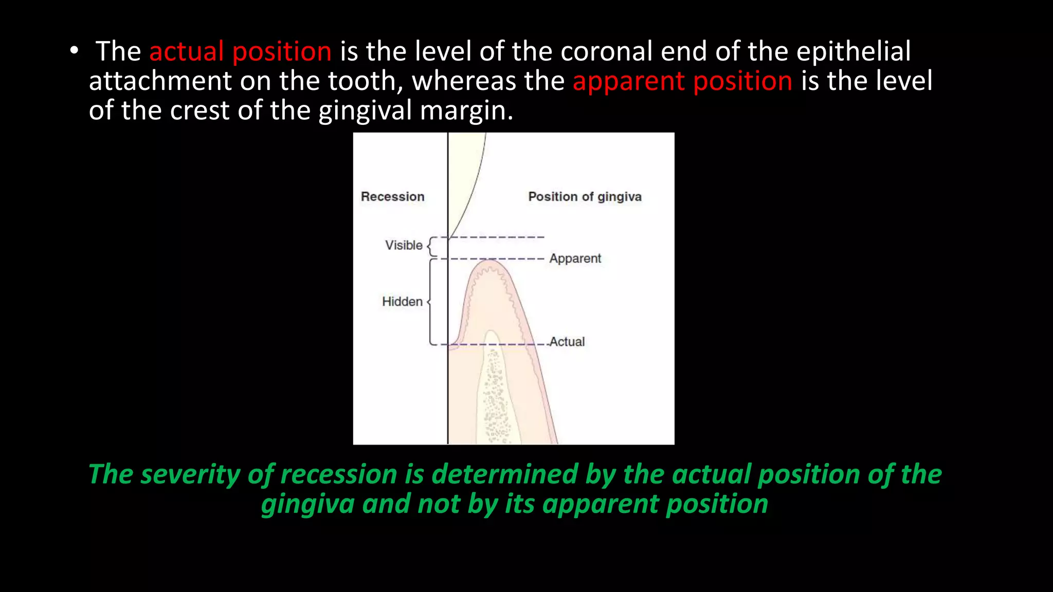 Clinical features of gingivitis | PPTX
