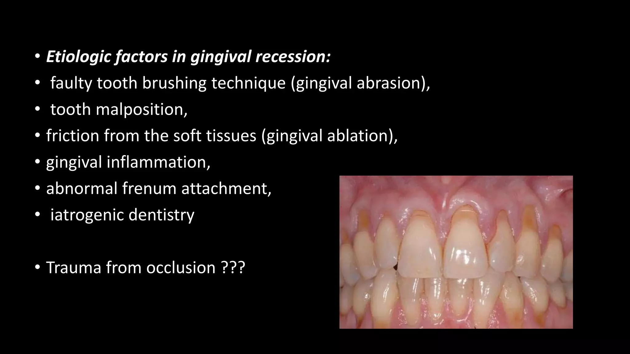 Clinical features of gingivitis | PPTX