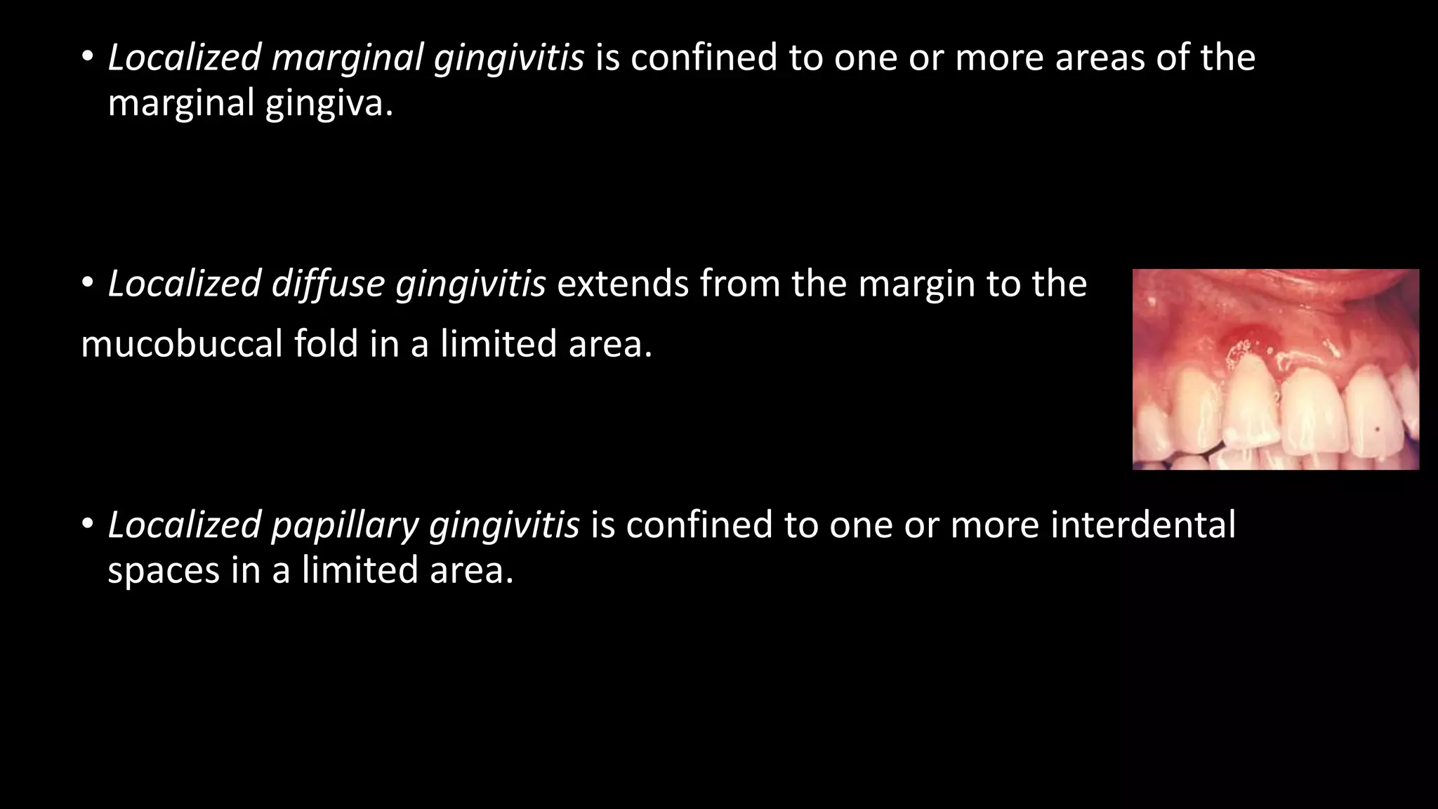 Clinical features of gingivitis | PPTX