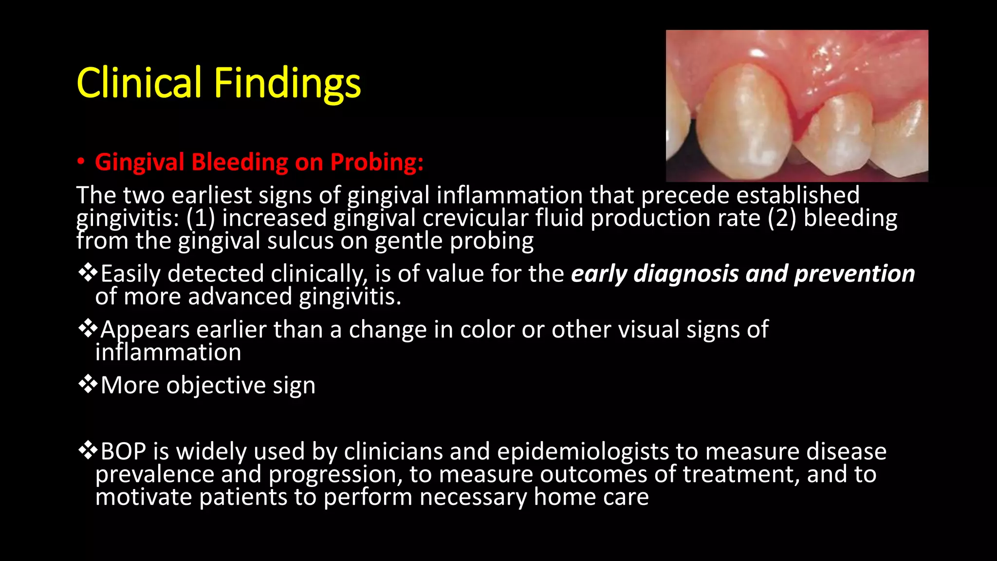 Clinical features of gingivitis | PPTX