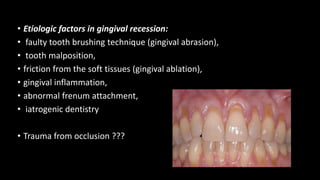Clinical features of gingivitis | PPTX