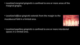 Clinical features of gingivitis | PPTX | Dental Health | Diseases and ...