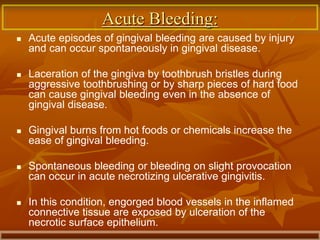 Clinical Features Of Gingivitis.ppt