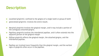 Clinical features of ginigvitis | PPTX