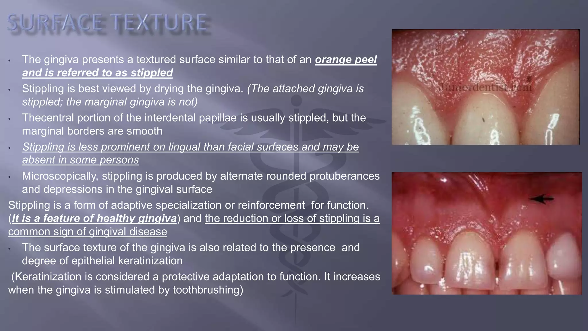 Clinical features of healthy gingiva | PPTX