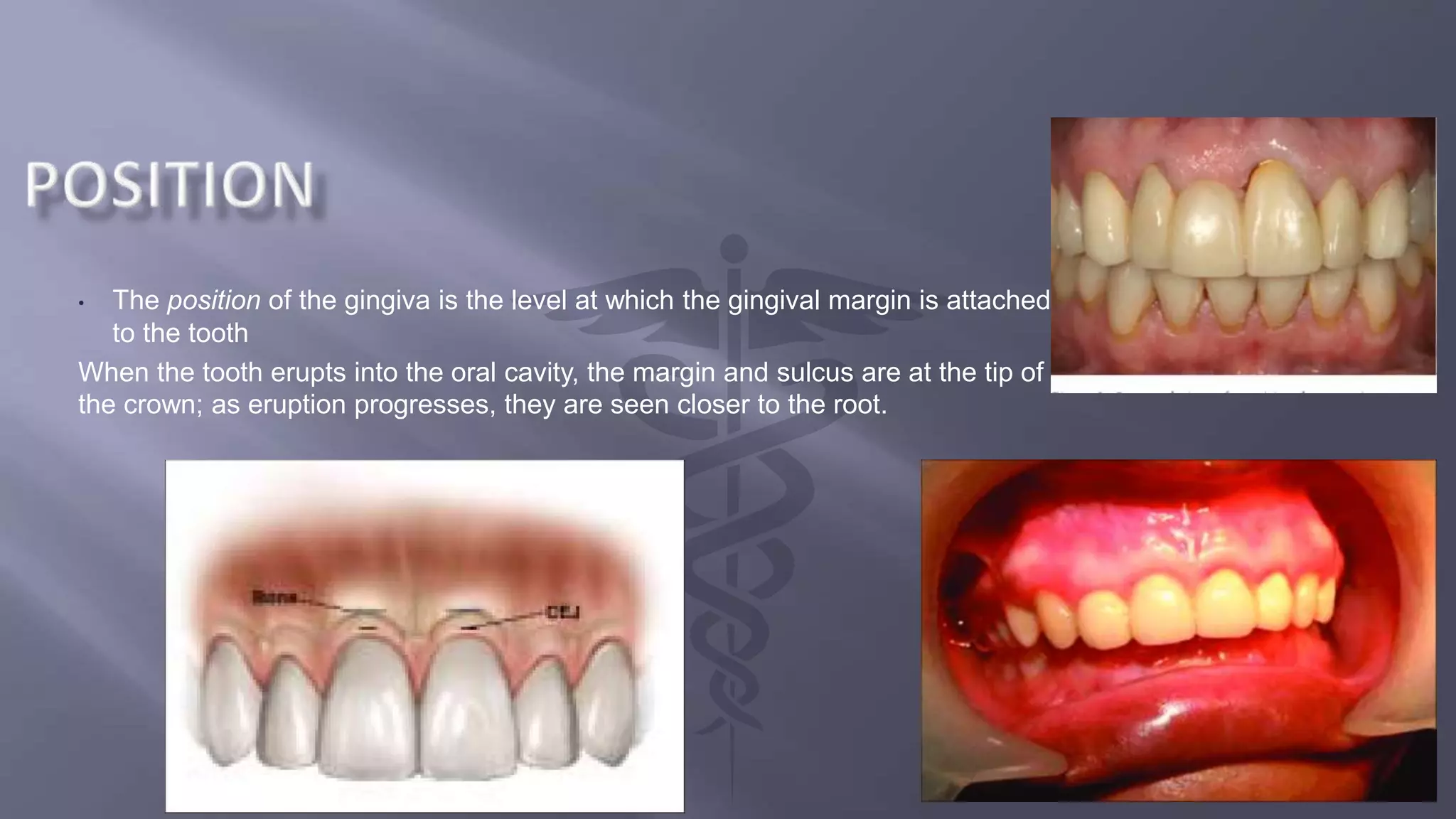 Clinical features of healthy gingiva | PPTX