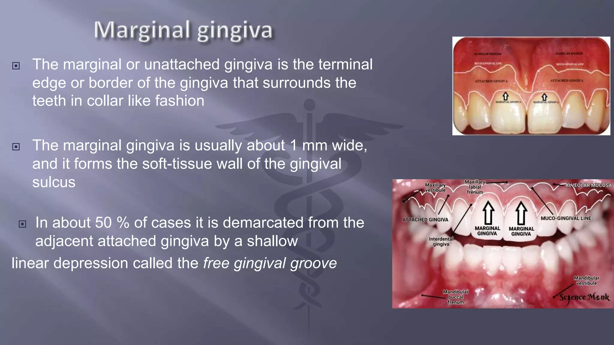 Clinical features of healthy gingiva | PPTX