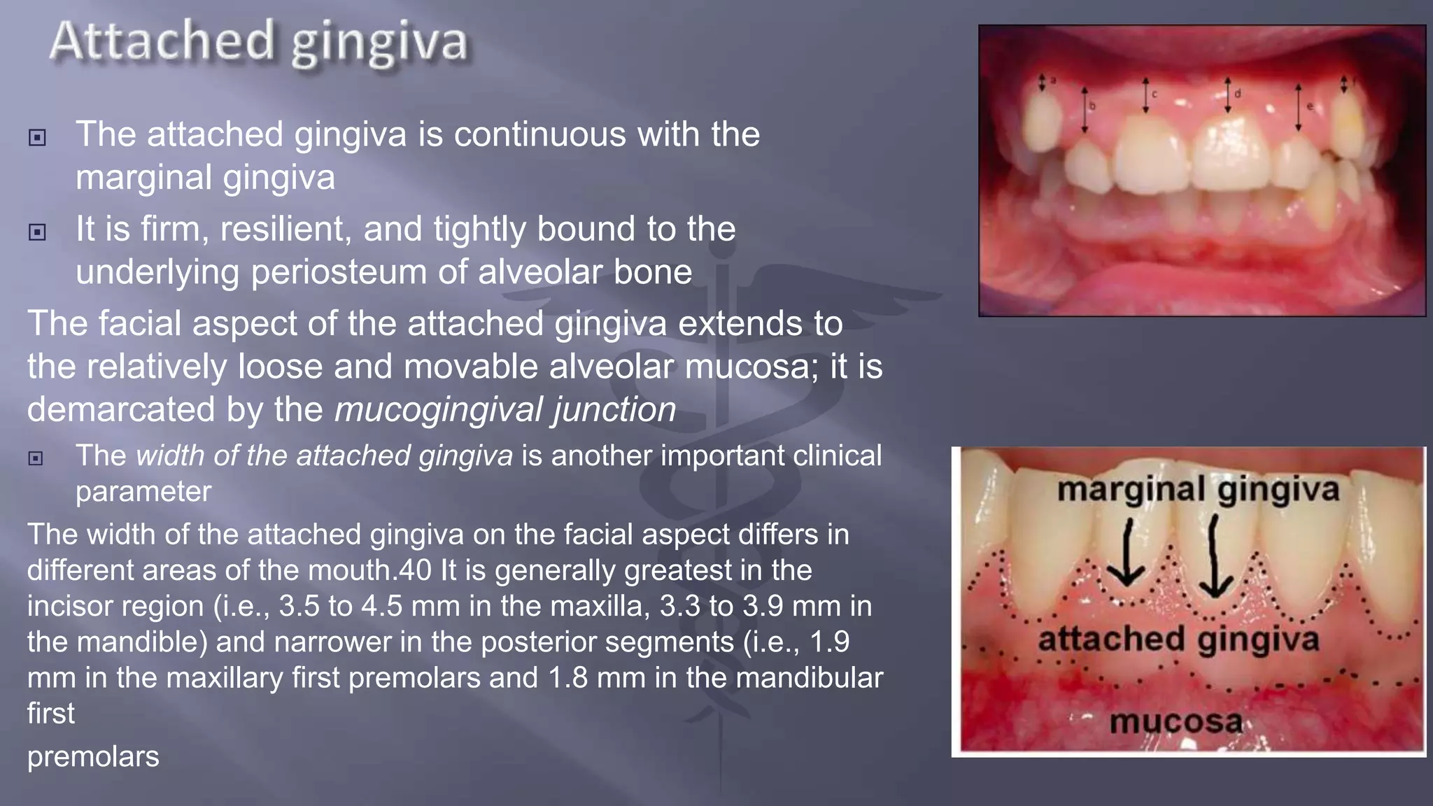 Clinical features of healthy gingiva | PPTX