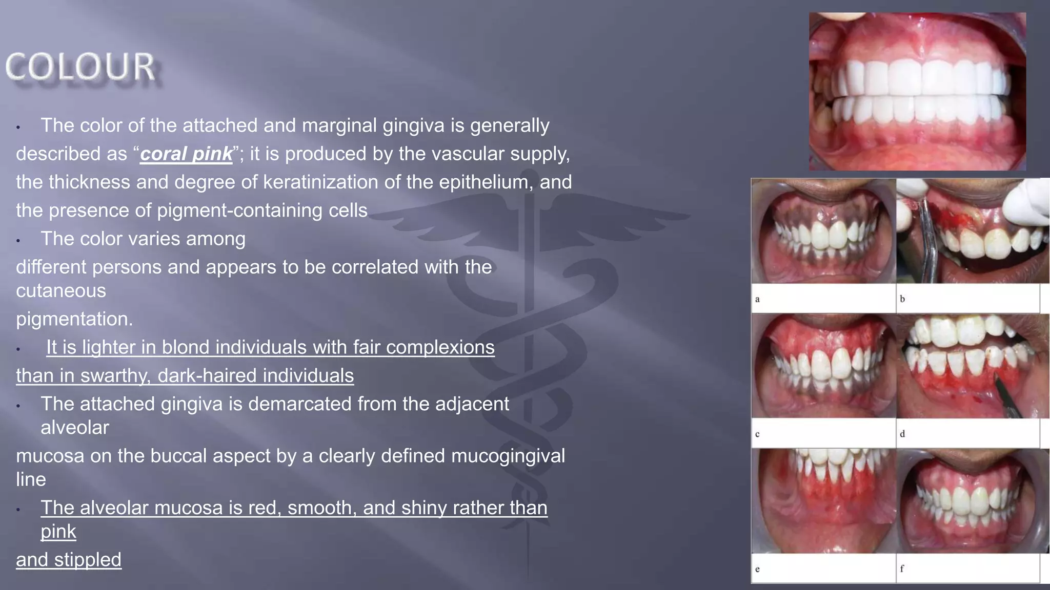 Clinical features of healthy gingiva | PPTX
