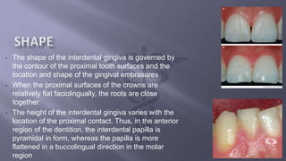 Clinical features of healthy gingiva | PPTX