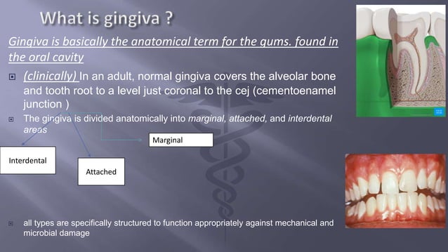 Clinical features of healthy gingiva | PPTX