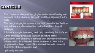 Clinical features of healthy gingiva | PPTX
