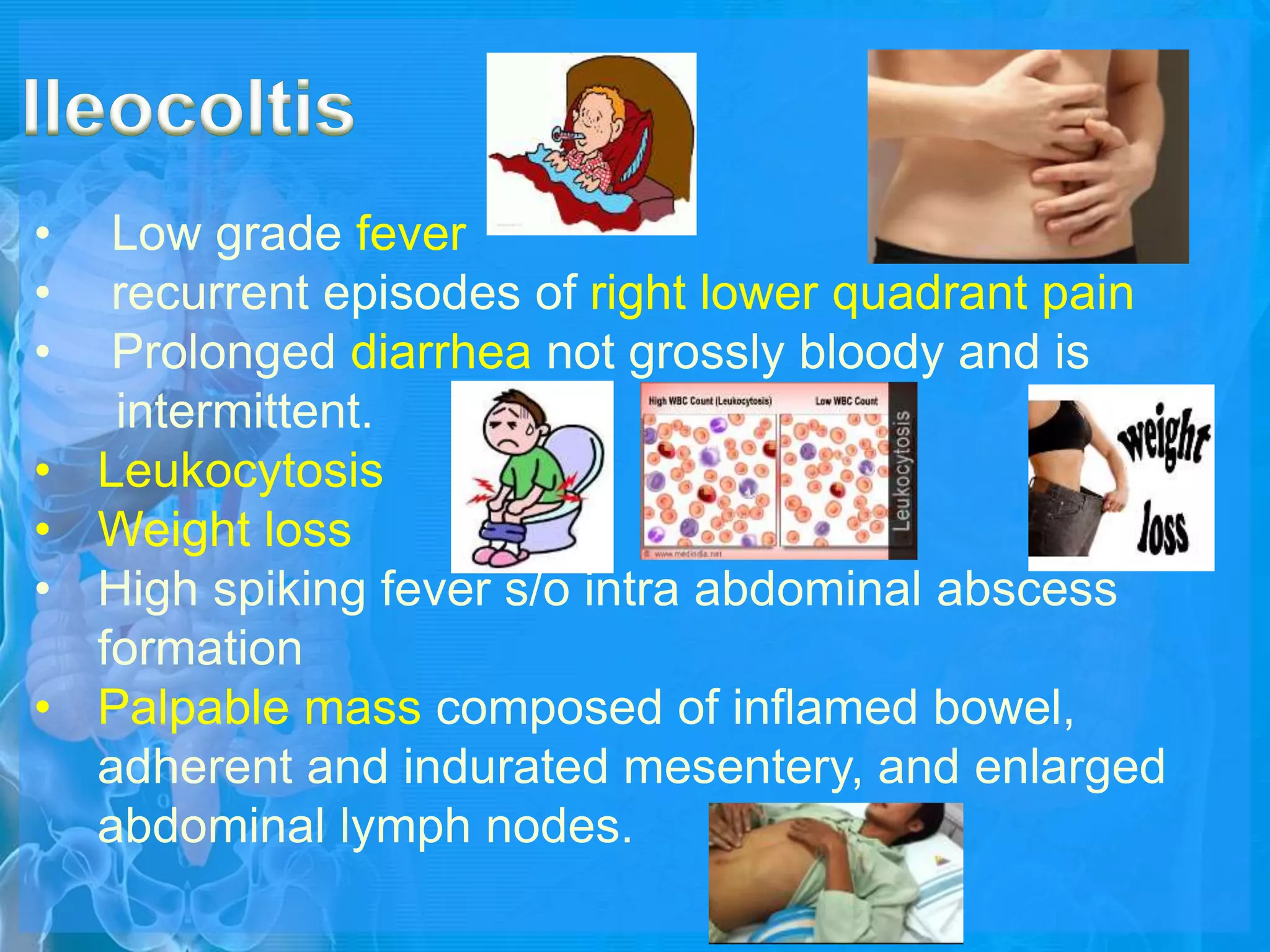 Inflammatory Bowel Disease Clinical features | PPTX