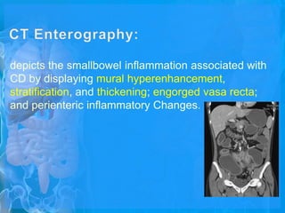Inflammatory Bowel Disease Clinical features | PPTX
