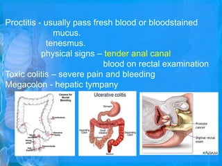 Inflammatory Bowel Disease Clinical features | PPT
