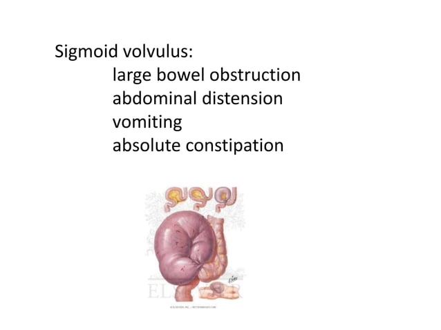 Clinical features of intestinal obstruction | PPTX