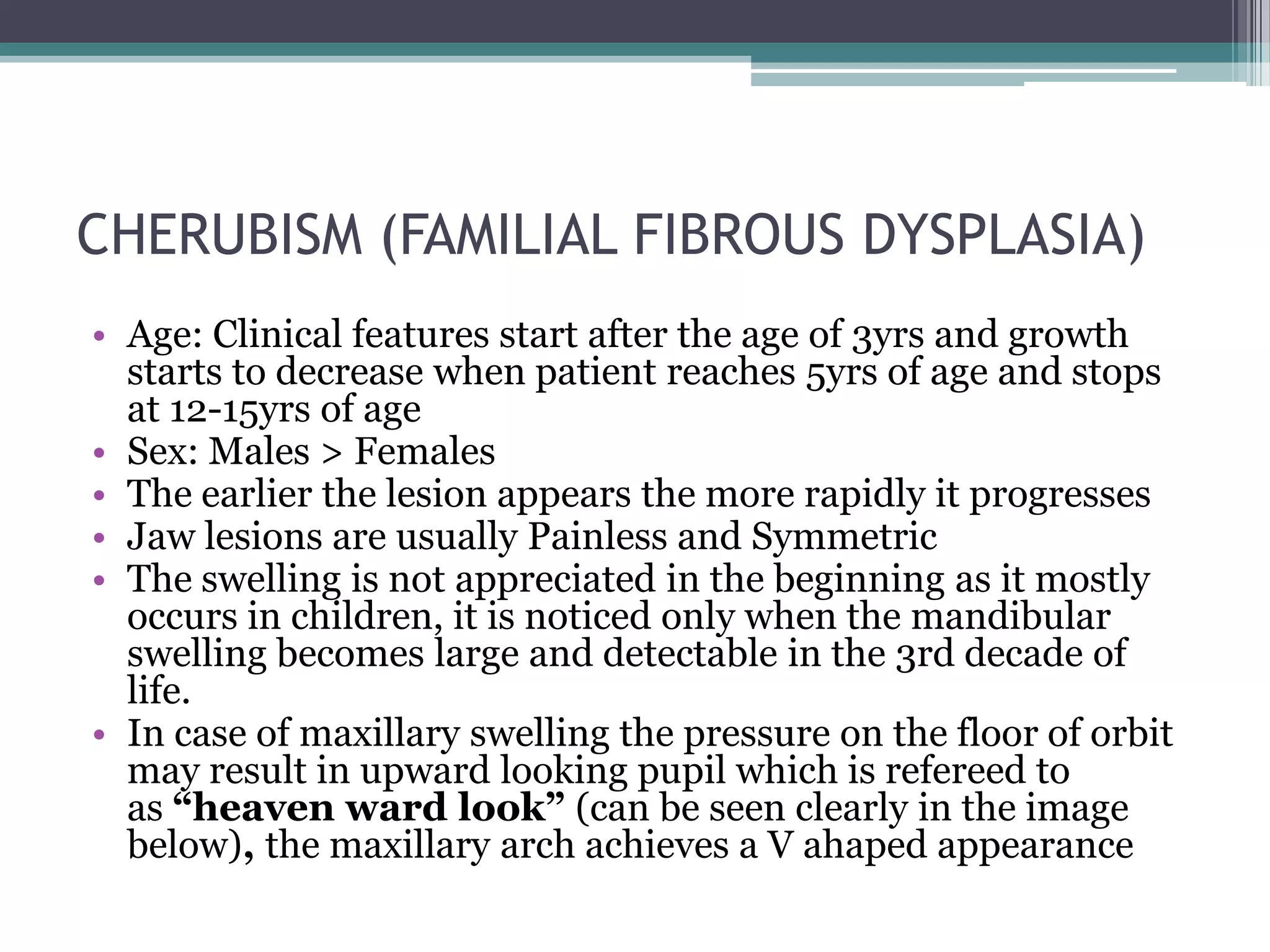 Clinical features of premature exfoliation | PPT