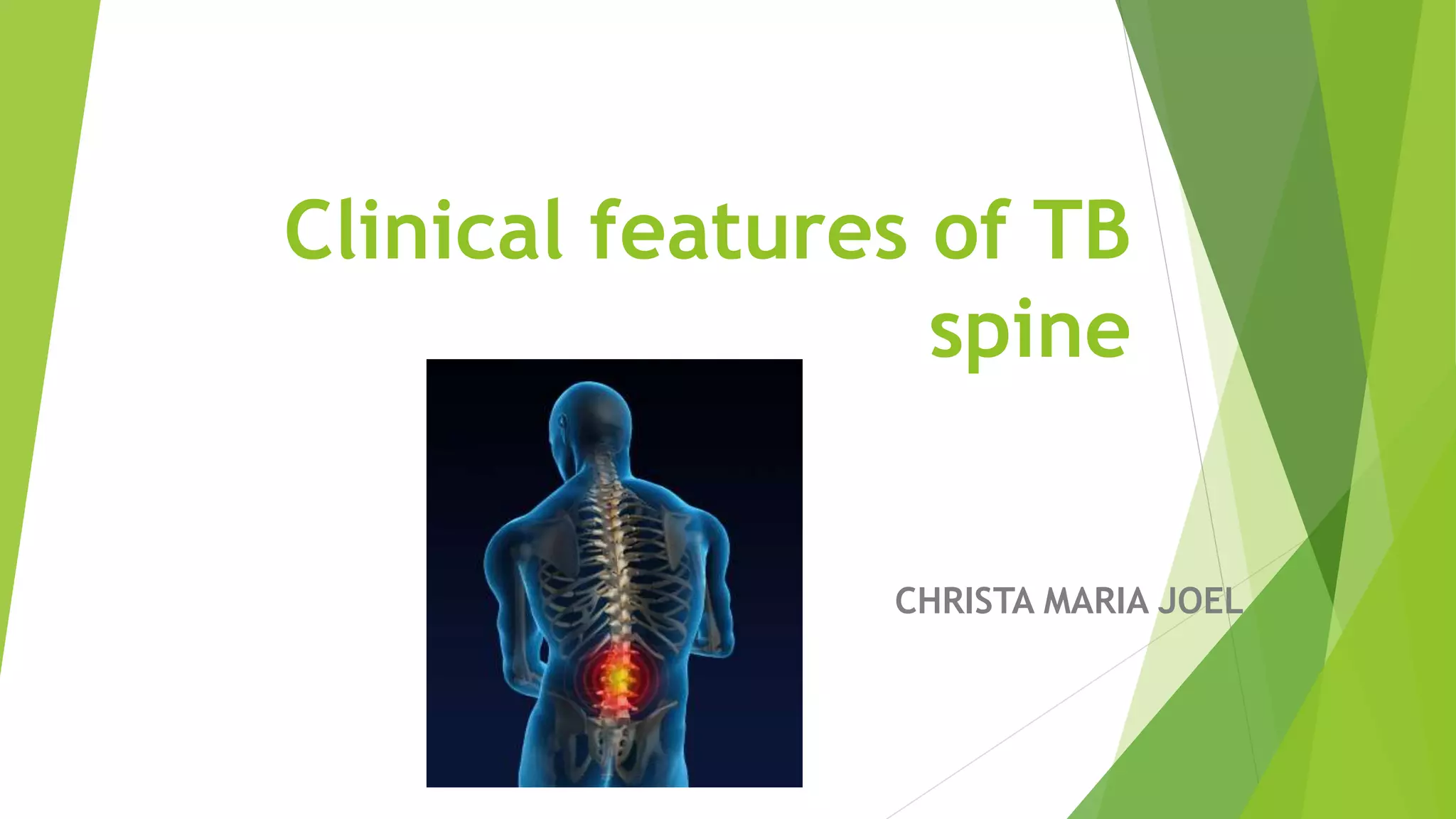 Clinical Features of TB Spine | PPTX