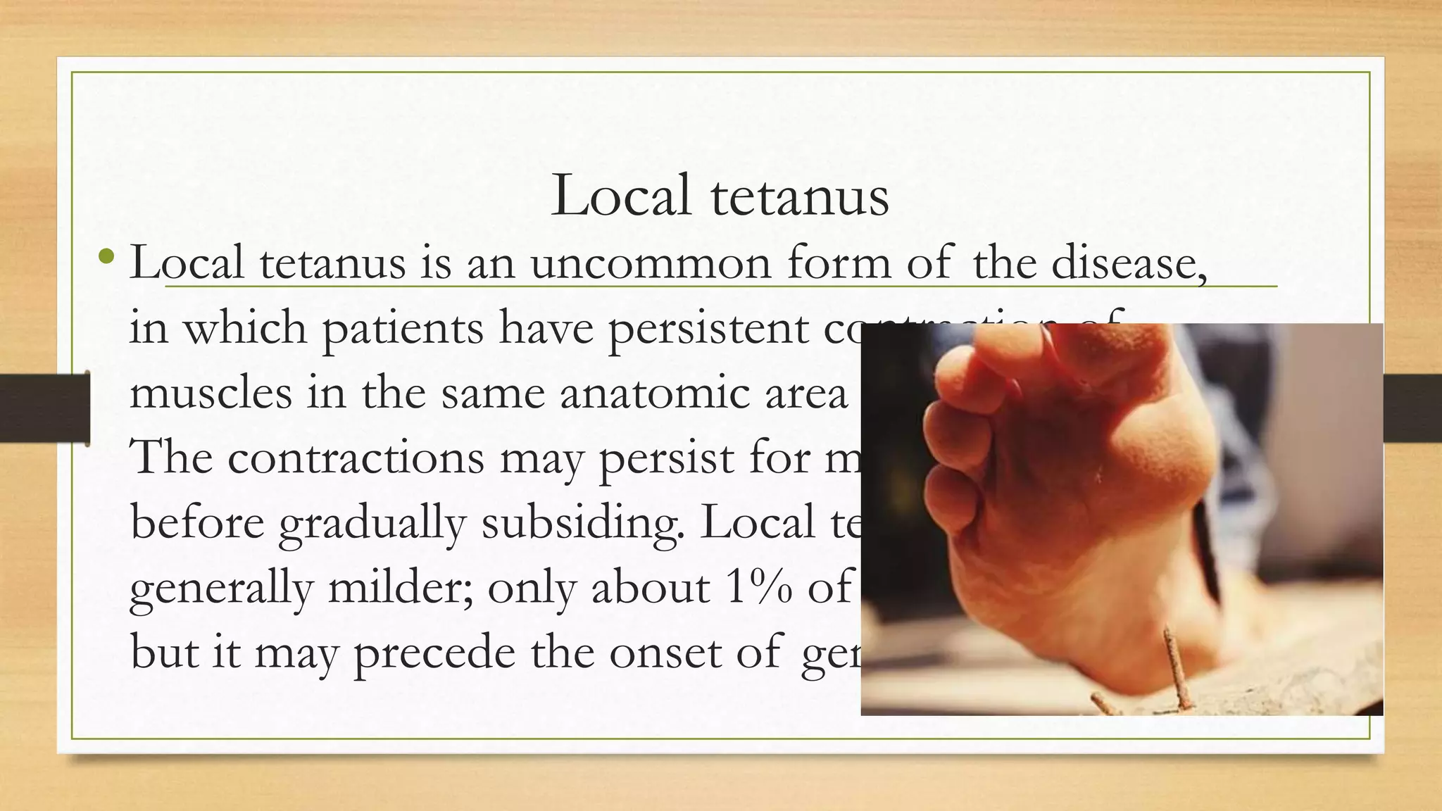 Clinical features of tetanus | PPTX