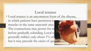 Clinical features of tetanus | PPTX