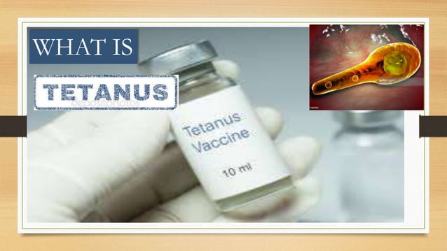 Clinical features of tetanus | PPTX