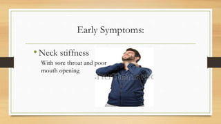 Clinical features of tetanus | PPTX