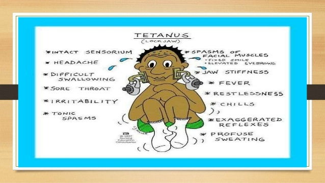 Clinical features of tetanus