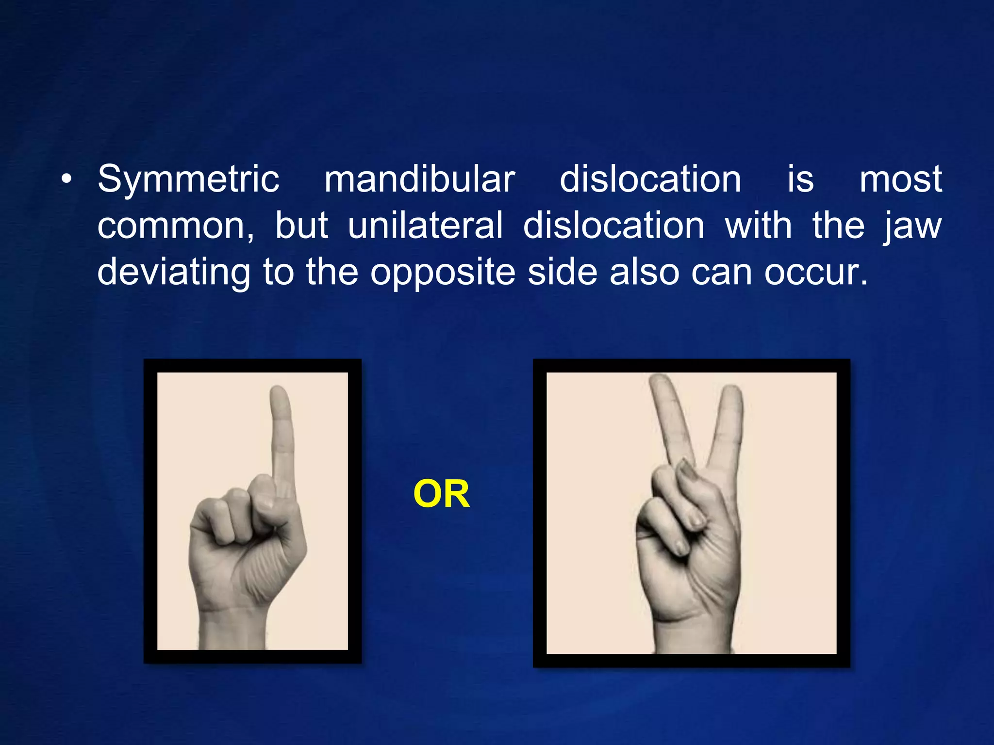 Clinical features of tmj dislocation | PPTX