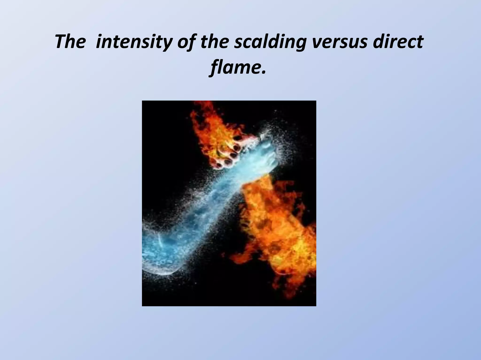 Clinical formula for management of pediatric scald burn | PPTX