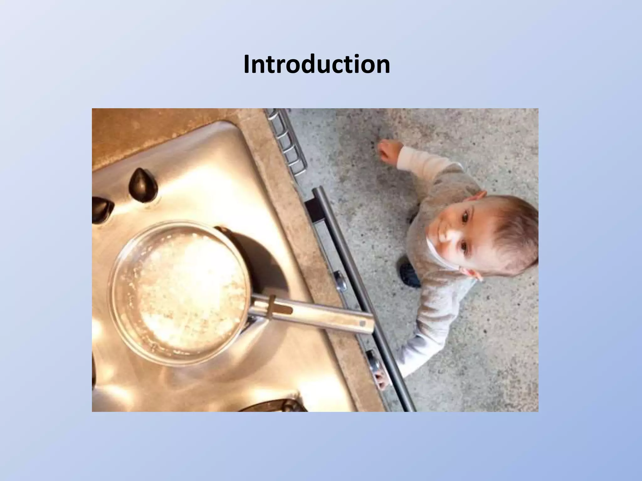 Clinical formula for management of pediatric scald burn | PPTX