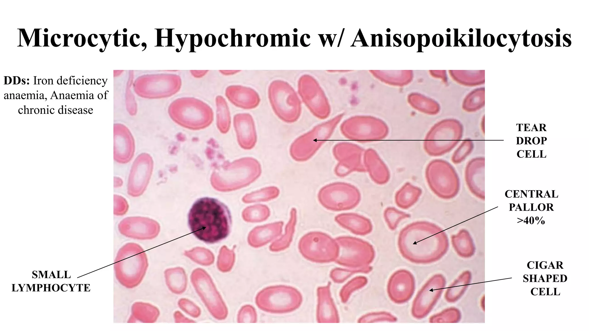 Clinical Haematology : Basic Guide | PPTX