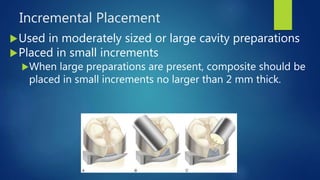 Clinical Handling of Composites | PPTX