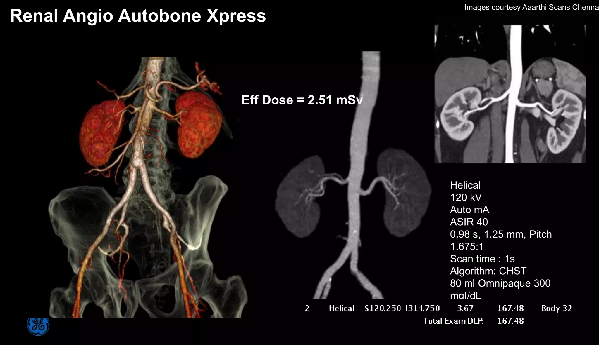 GE Healthcare Revolution ACT EX Clinical Image Gallery | PPTX