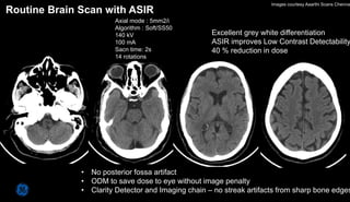 GE Healthcare Revolution ACT EX Clinical Image Gallery | PPT