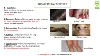 Clinical Immunology, Piyush Karan.pptx | Infectious Diseases | Diseases ...