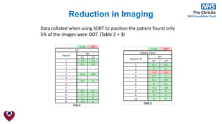 Clinical implementation of Surface Guided Radiotherapy (SGRT) for ...