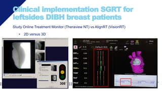 Clinical implementation of tattooless treatment for breast cancer ...